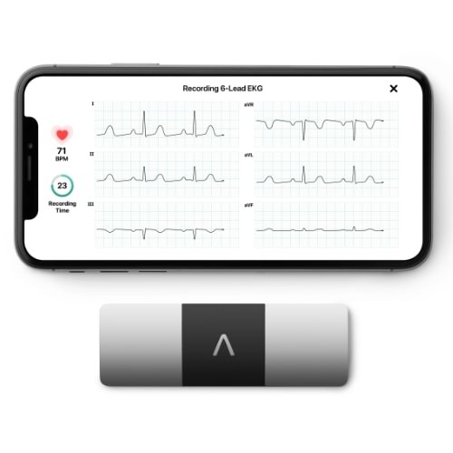 Kardia Mobile 6L kopen? | Bestel via de officiële Distributeur.