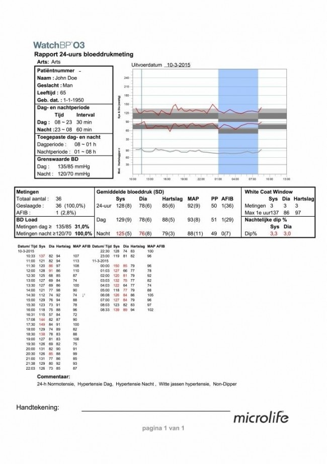 Microlife® WatchBP® O3 Kopen? Bestel een 24 uurs bloeddrukmeter!